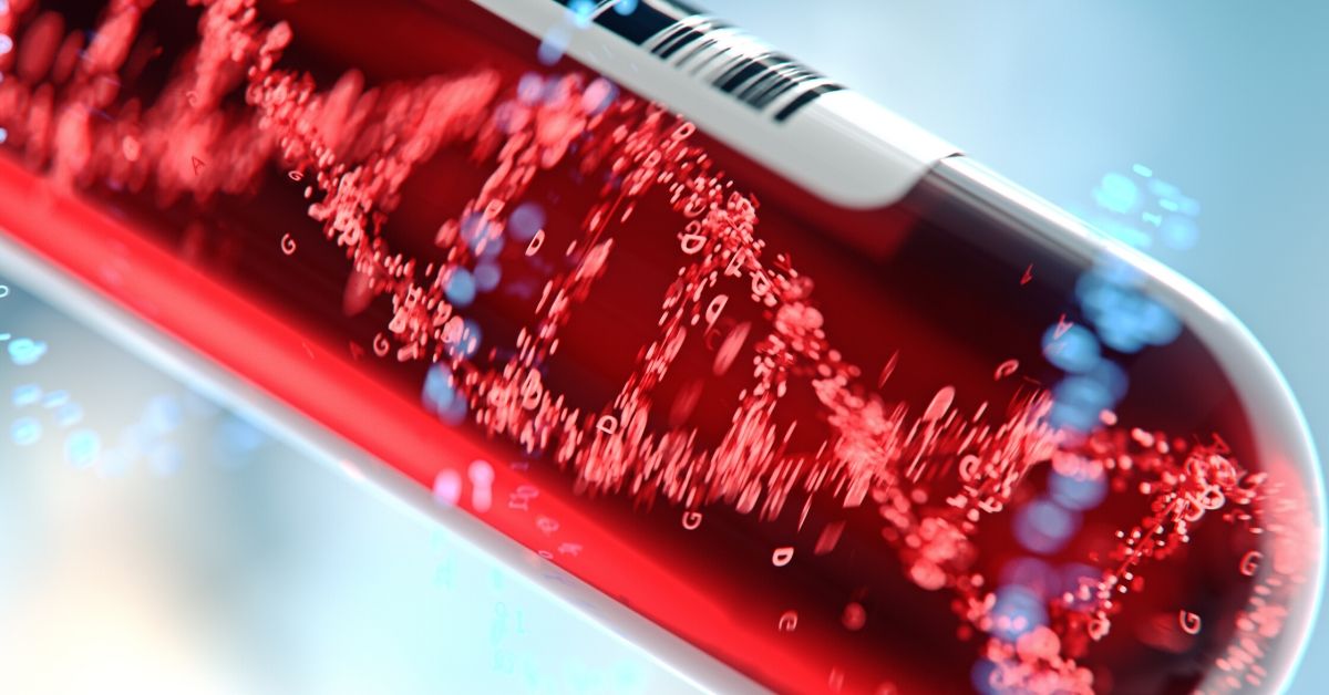 Blood Test Results Explained in Detail Online – Setu Nutrition